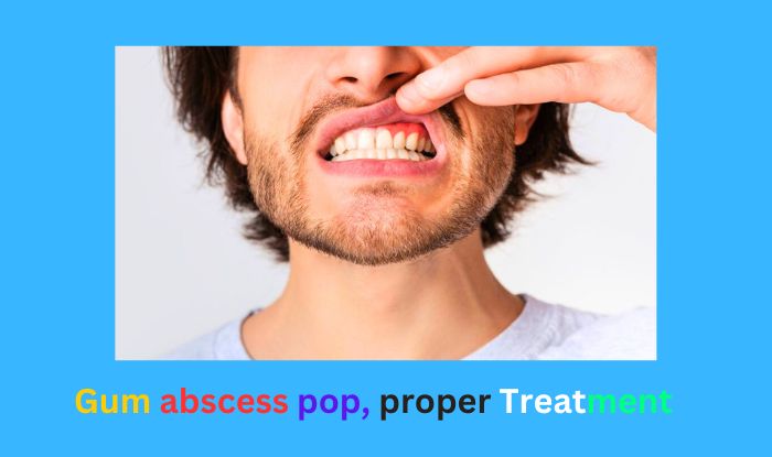 Gum abscess pop | Symptoms, Treatment and Risks - CMH HEALTHS
