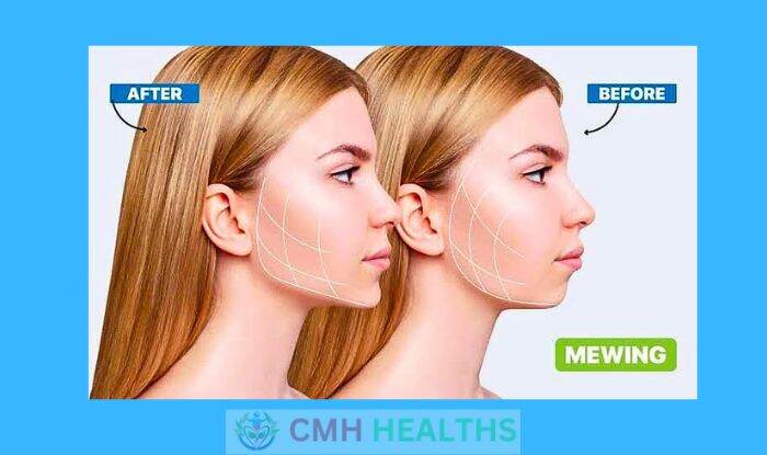 How to Mew properly step by step guide - CMH HEALTHS